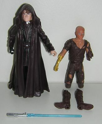 Star Wars Loose Anakin Skywalker ( Battle Damage ) ROTS - Xpress ...